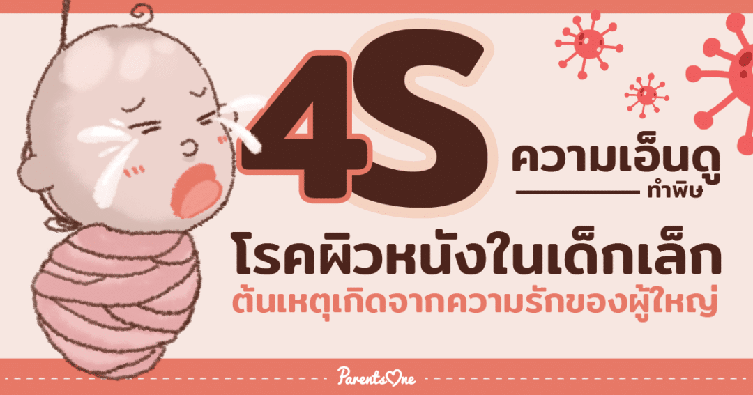 ความเอ็นดูทำพิษ 4S โรคผิวหนังในเด็กเล็ก ต้นเหตุเกิดจากความรักของผู้ใหญ่