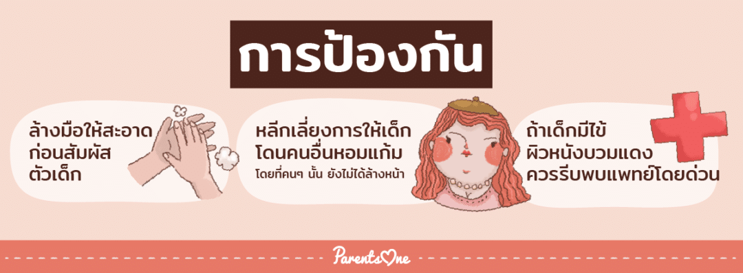 ความเอ็นดูทำพิษ 4S โรคผิวหนังในเด็กเล็ก ต้นเหตุเกิดจากความรักของผู้ใหญ่