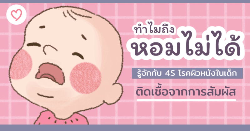 ทำไมถึงหอมไม่ได้ รู้จักกับ 4S โรคผิวหนังในเด็กติดเชื้อจากการสัมผัส
